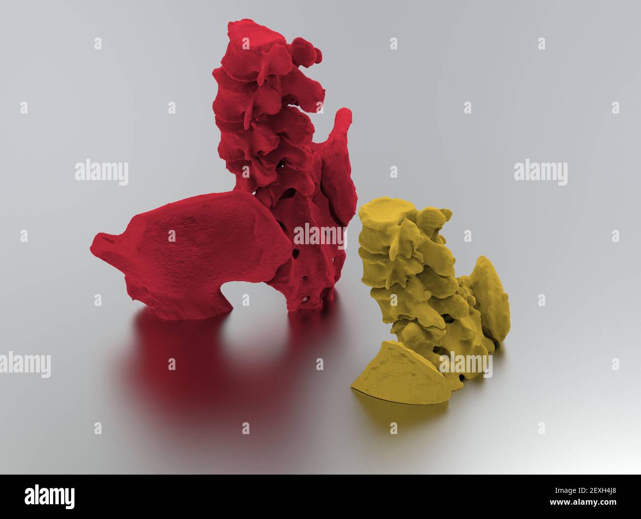 Model of human colored spine bones on metallic background, lower part ...