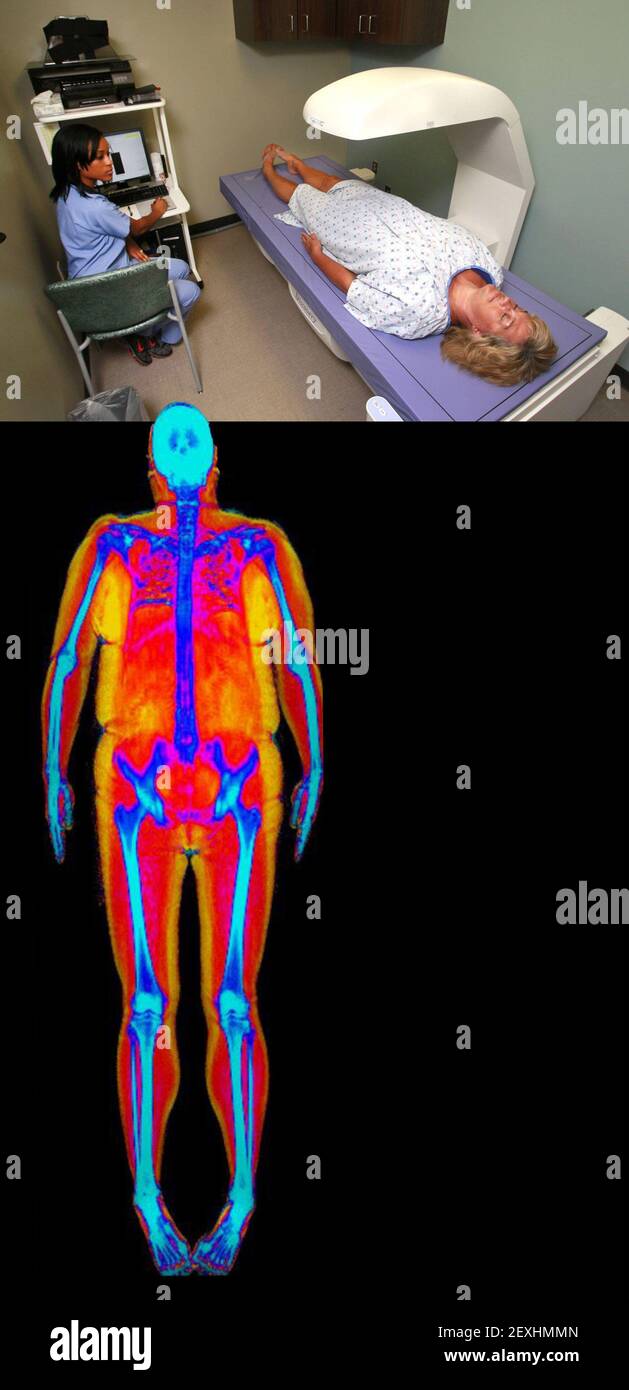 A full-body scan helped Michelle Sullivan commit to changing her weight ...