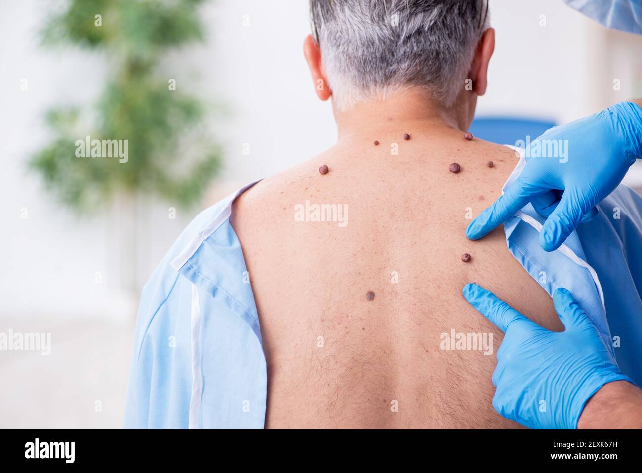 Old man visiting male doctor dermatologist Stock Photo - Alamy