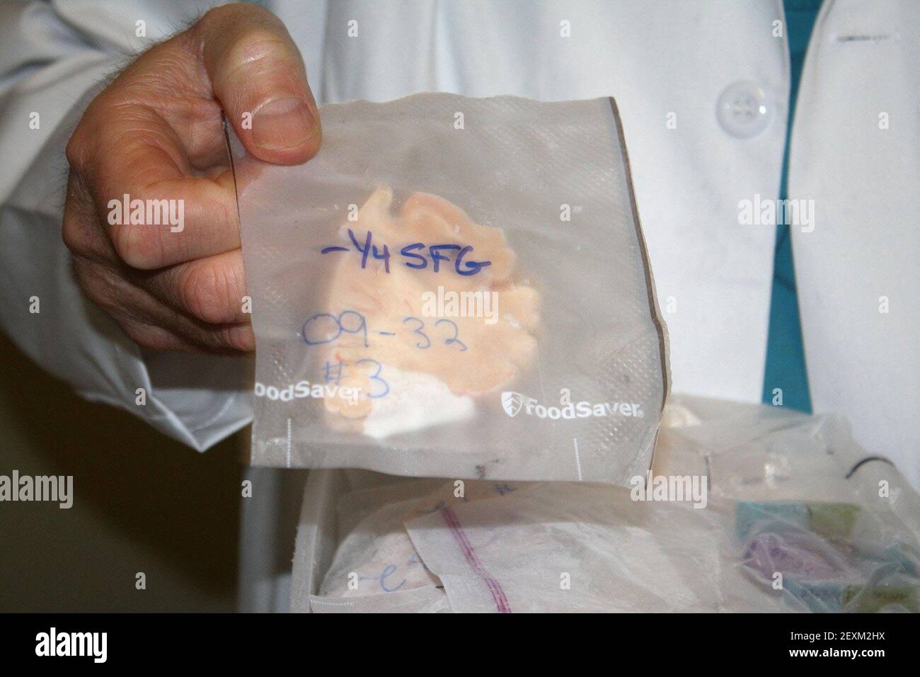 Removed on average within three hours of a donorâ€™s death, sections of ...