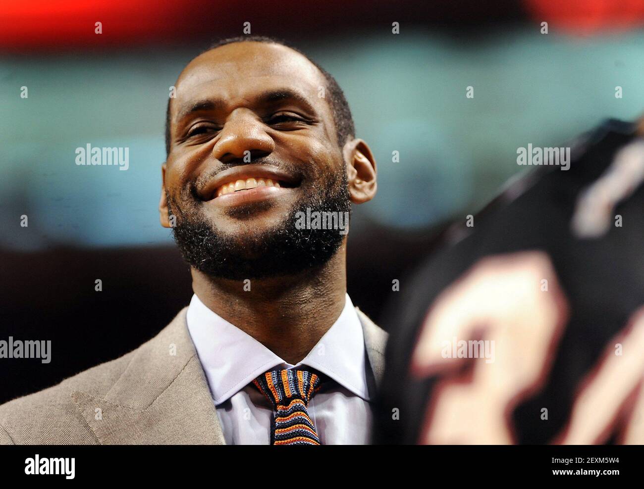 Lebron James Broken Nose