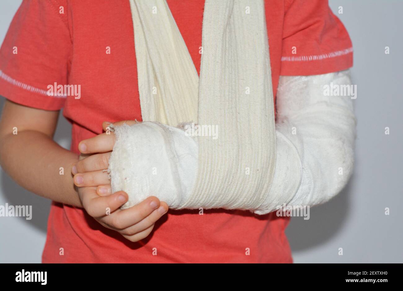 A close-up of a child, a four-year-old boy with a broken arm in a cast ...