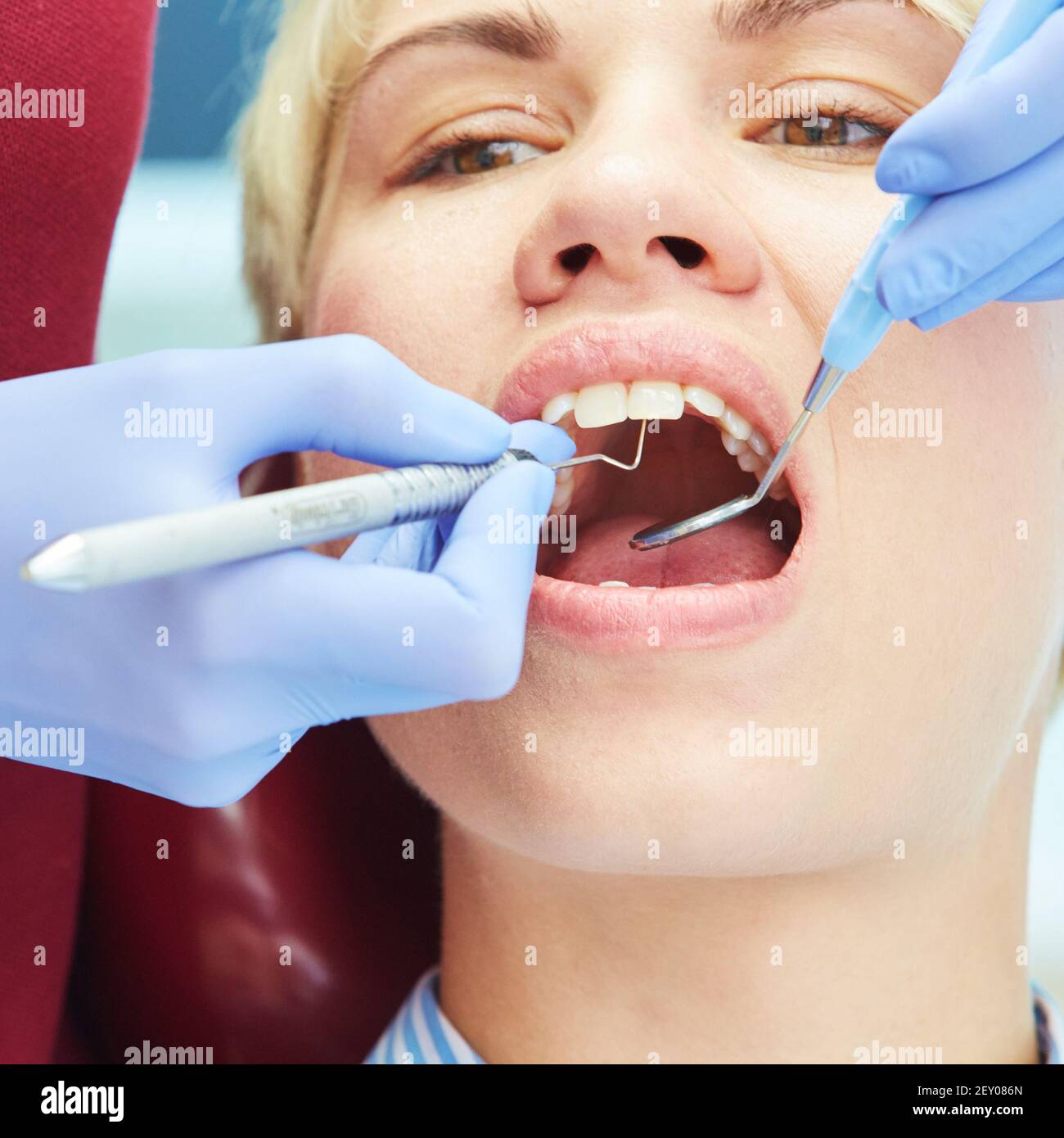 Close up woman mouth open teeth hi-res stock photography and images - Alamy