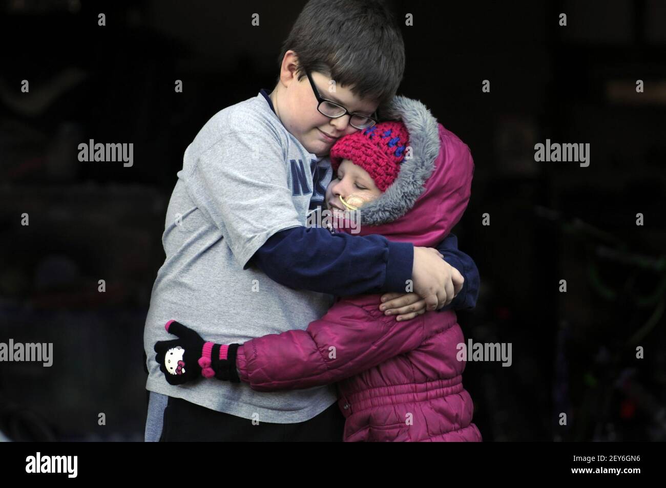 Emma Duffin, 8, gets a hug from her brother Alex, 11, at home in ...