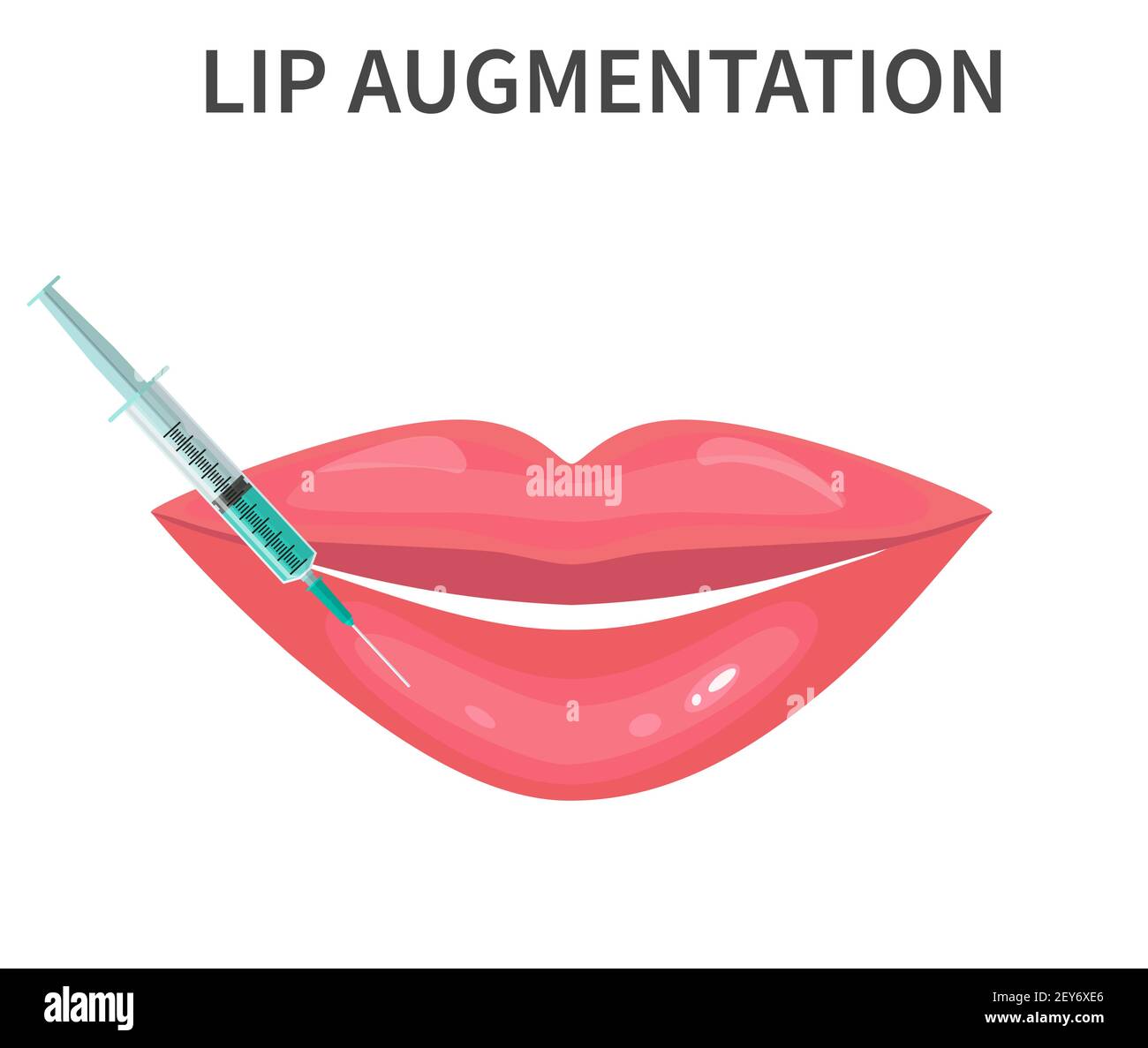 Medical augmentation Stock Vector Images - Alamy