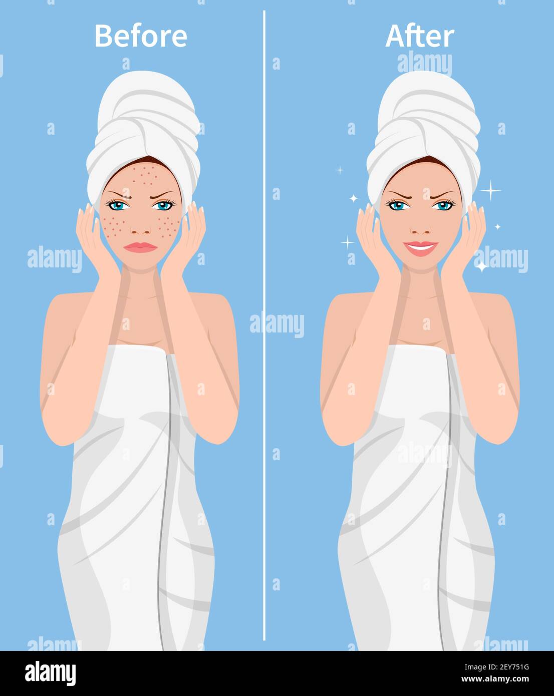 Pimple cure vector hi-res stock photography and images - Alamy