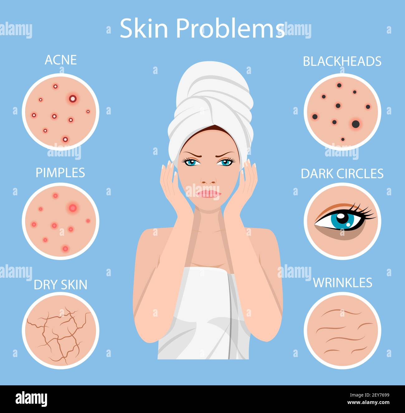 Woman facial skin problems Stock Vector Image & Art - Alamy