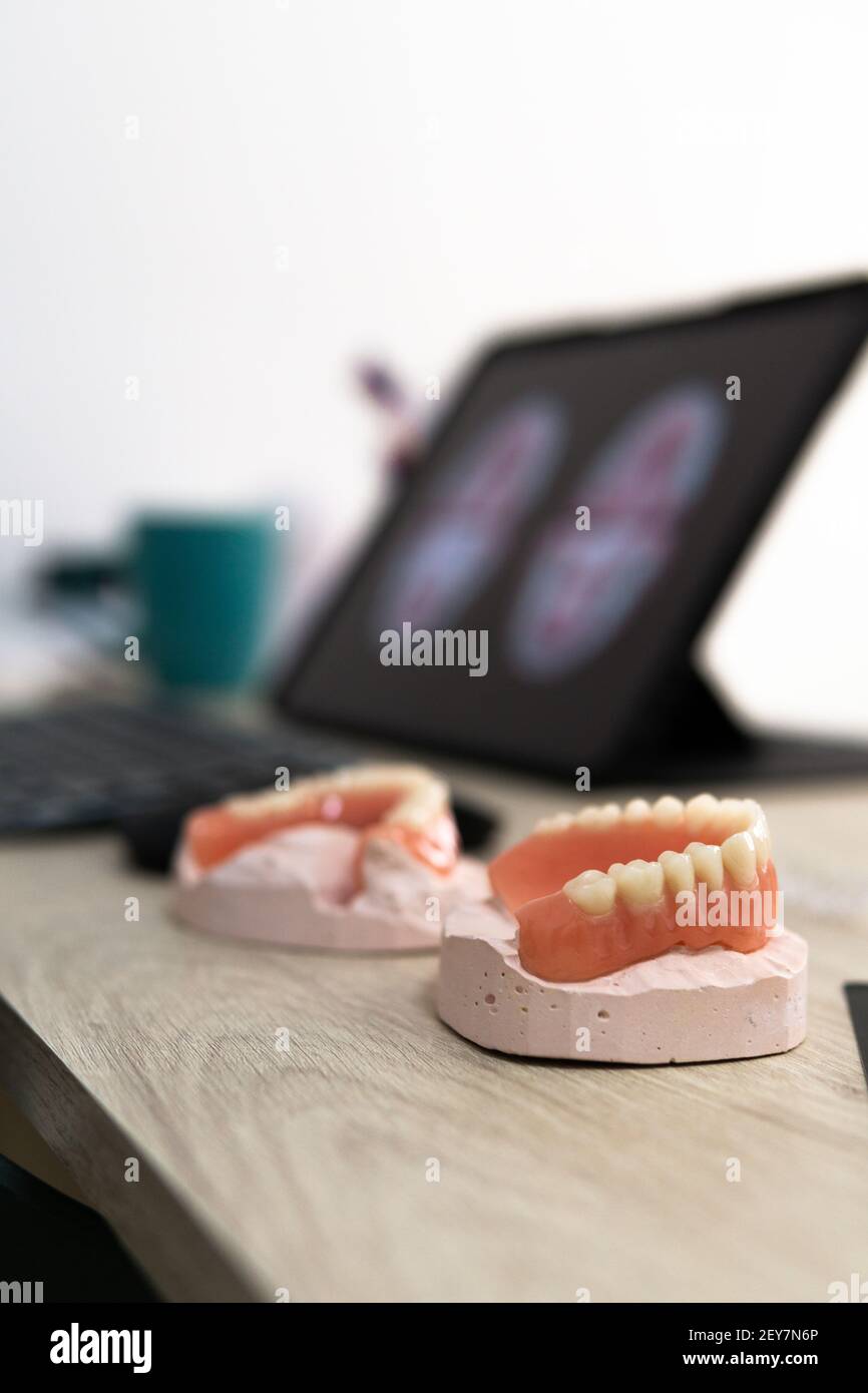 A vertical shot of prosthetic sets of teeth and pictures of jaws on a ...