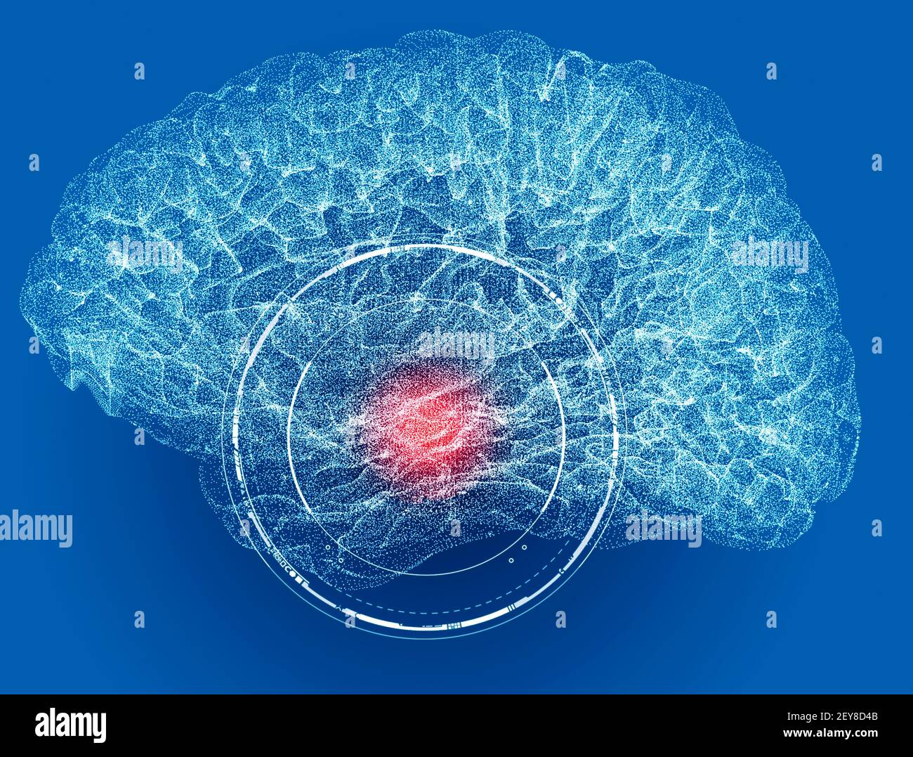 Pain in the head, brain and synapses, cognitive problems, mental ...