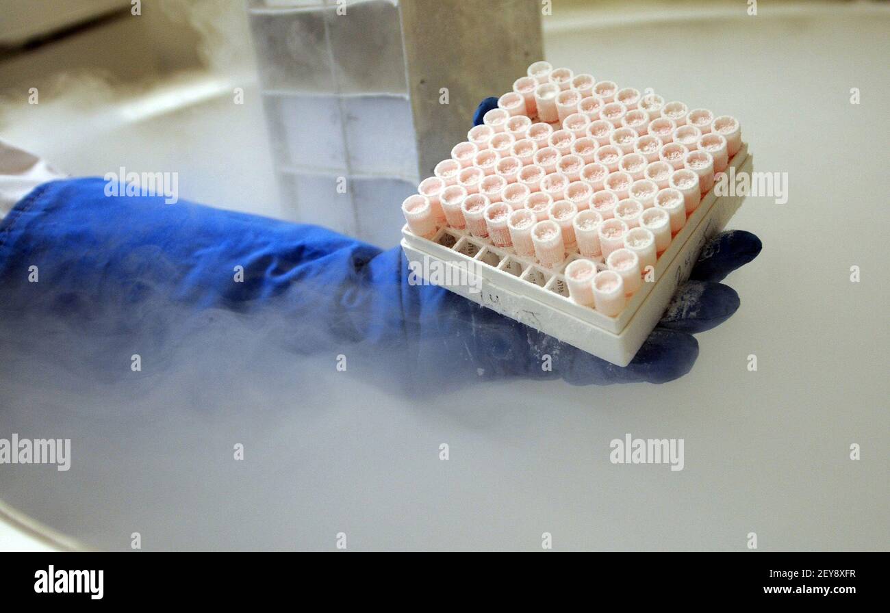 A tray of cryovials of umbilical cord blood mononuclear cells is seen ...