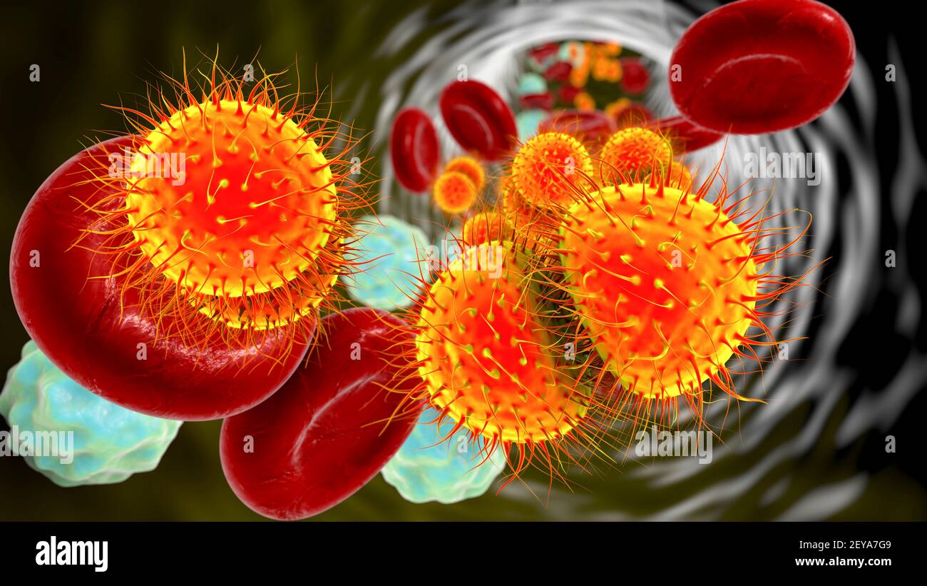 Meningococcal sepsis hi-res stock photography and images - Alamy