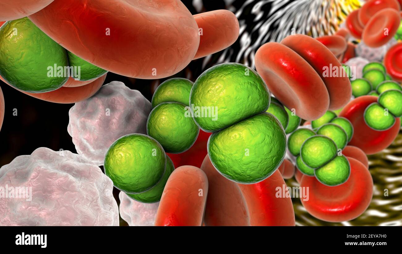 Meningococcal sepsis hi-res stock photography and images - Alamy