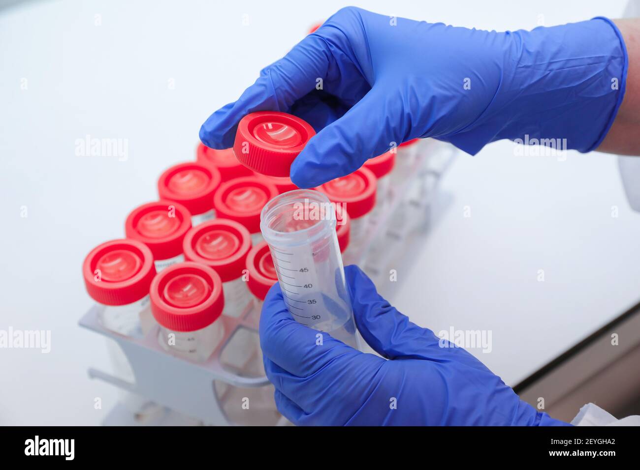 Hand with medical glove holding one laboratory test tube from a batch ...