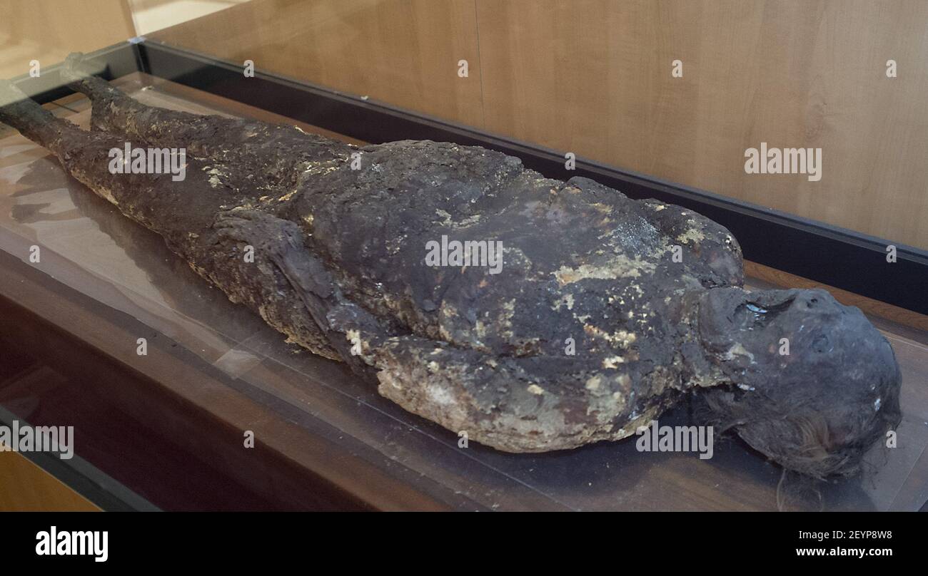 The "Soap Woman" mummy is on display at the Mutter Museum of The ...