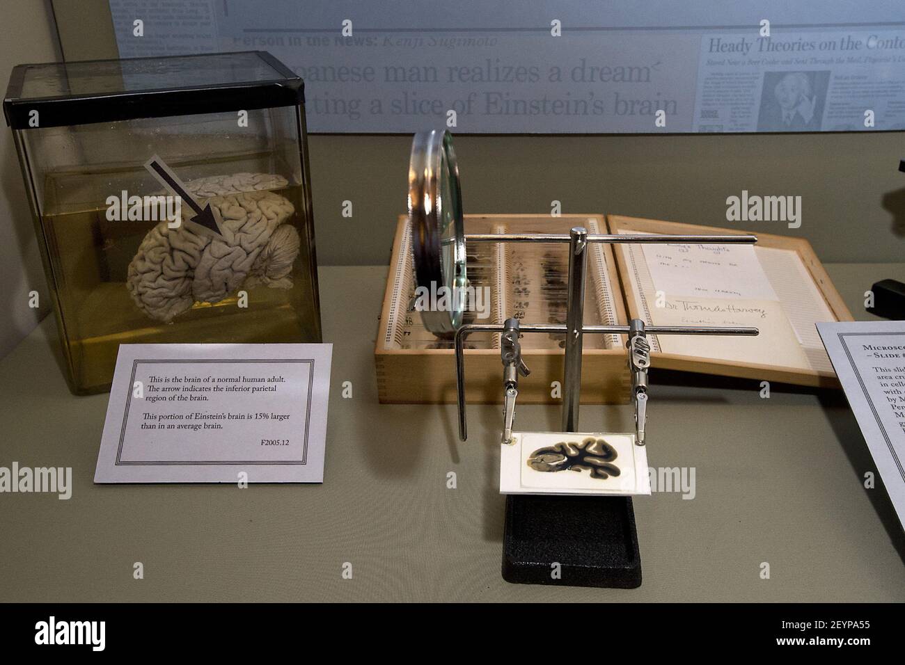 A specimen of Albert Einstein's brain is on display at the Mutter ...