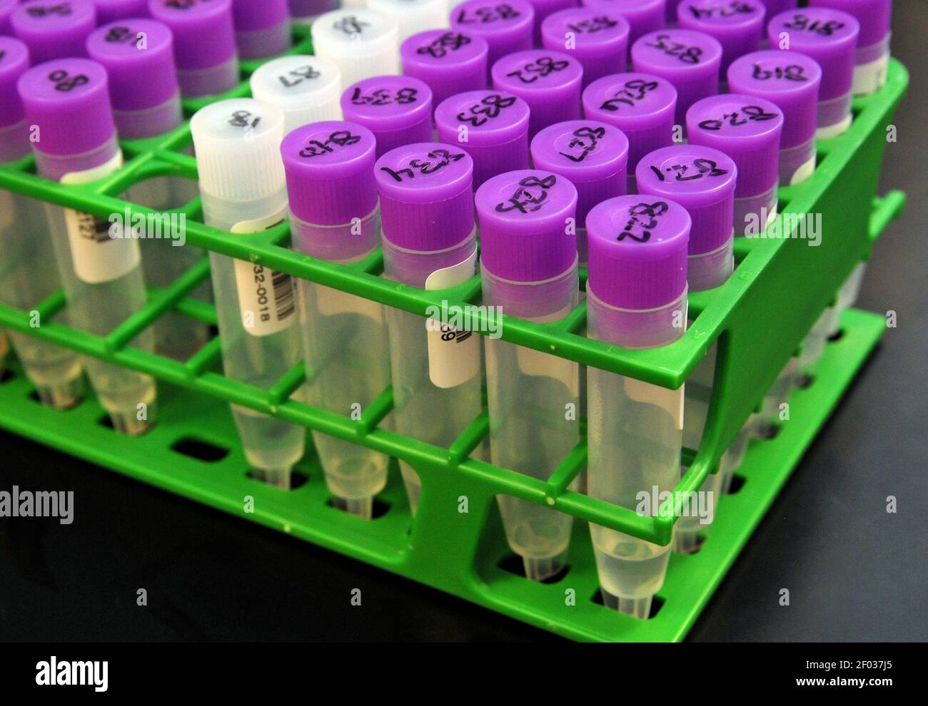 A close-up view of saliva samples collected from children's swabs, in ...