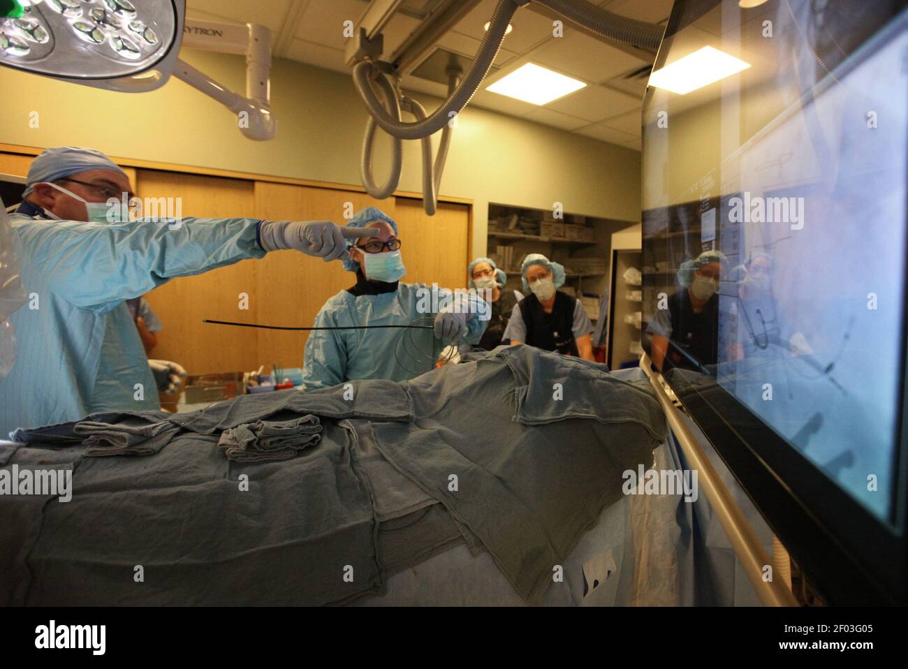 Dr. Pierce Vatterott, left, watched a monitor during the removal of ...