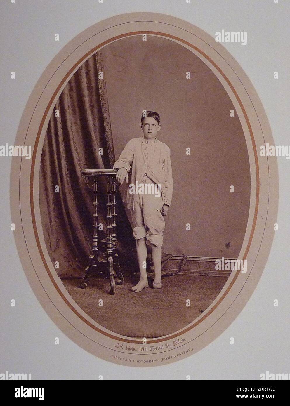 Pirogoff hi-res stock photography and images - Alamy