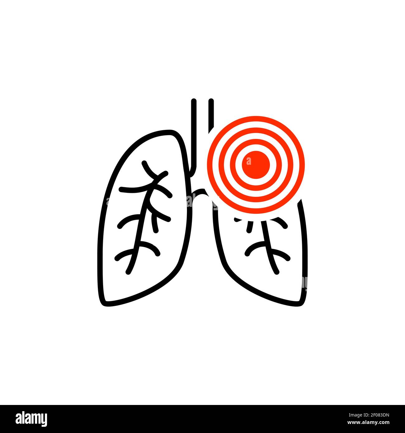 Pneumonia respiratory inflamed icon vector asthma pulmonology logo ...
