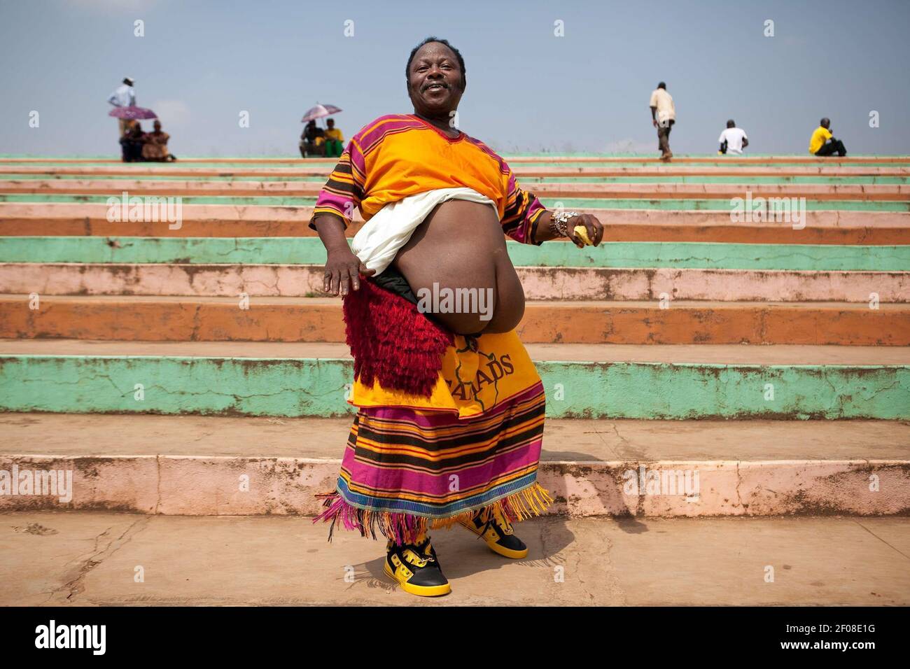 July 3, 2011 - Kampala, Uganda - Moses Kawooya is a 59-year-old obese ...