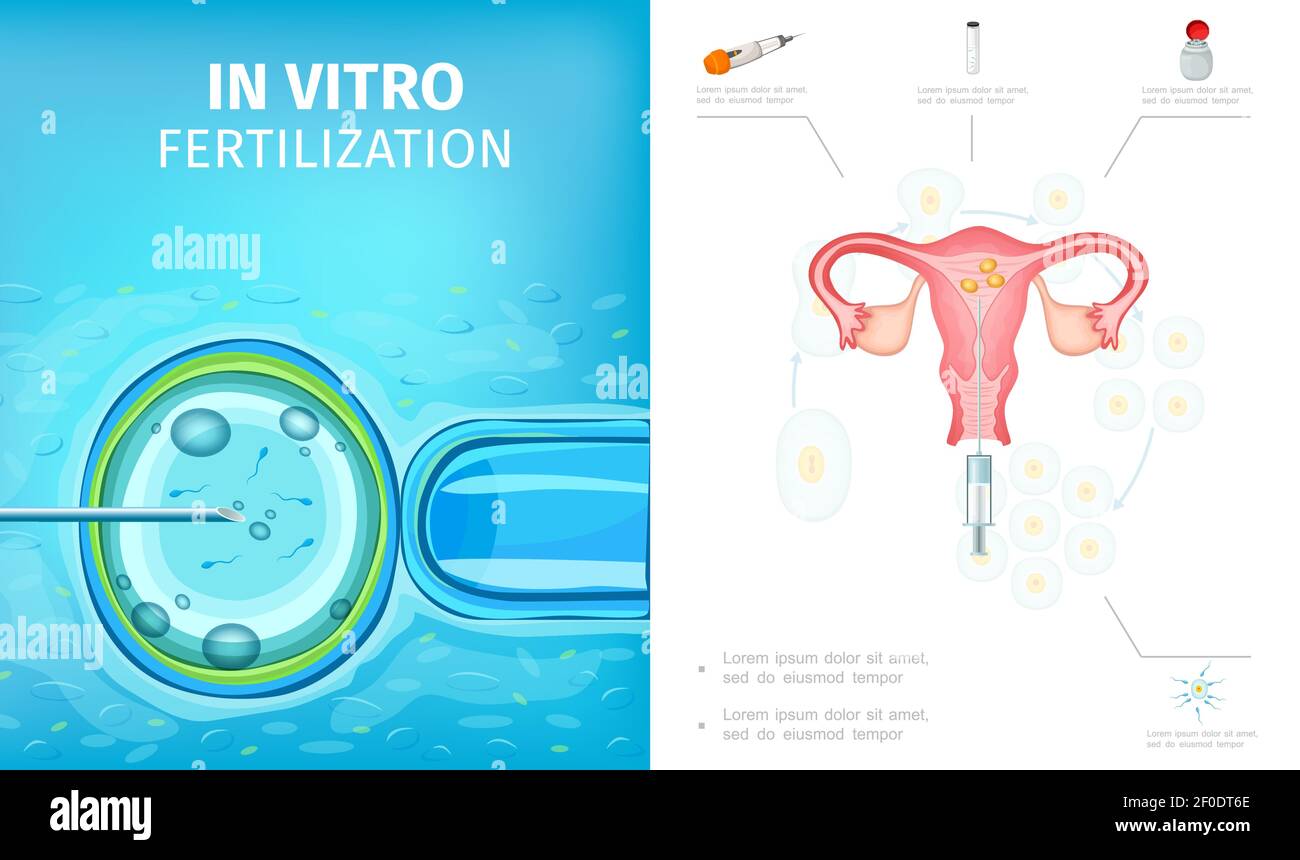 Female Reproductive System Fertilization Process Anatomy And