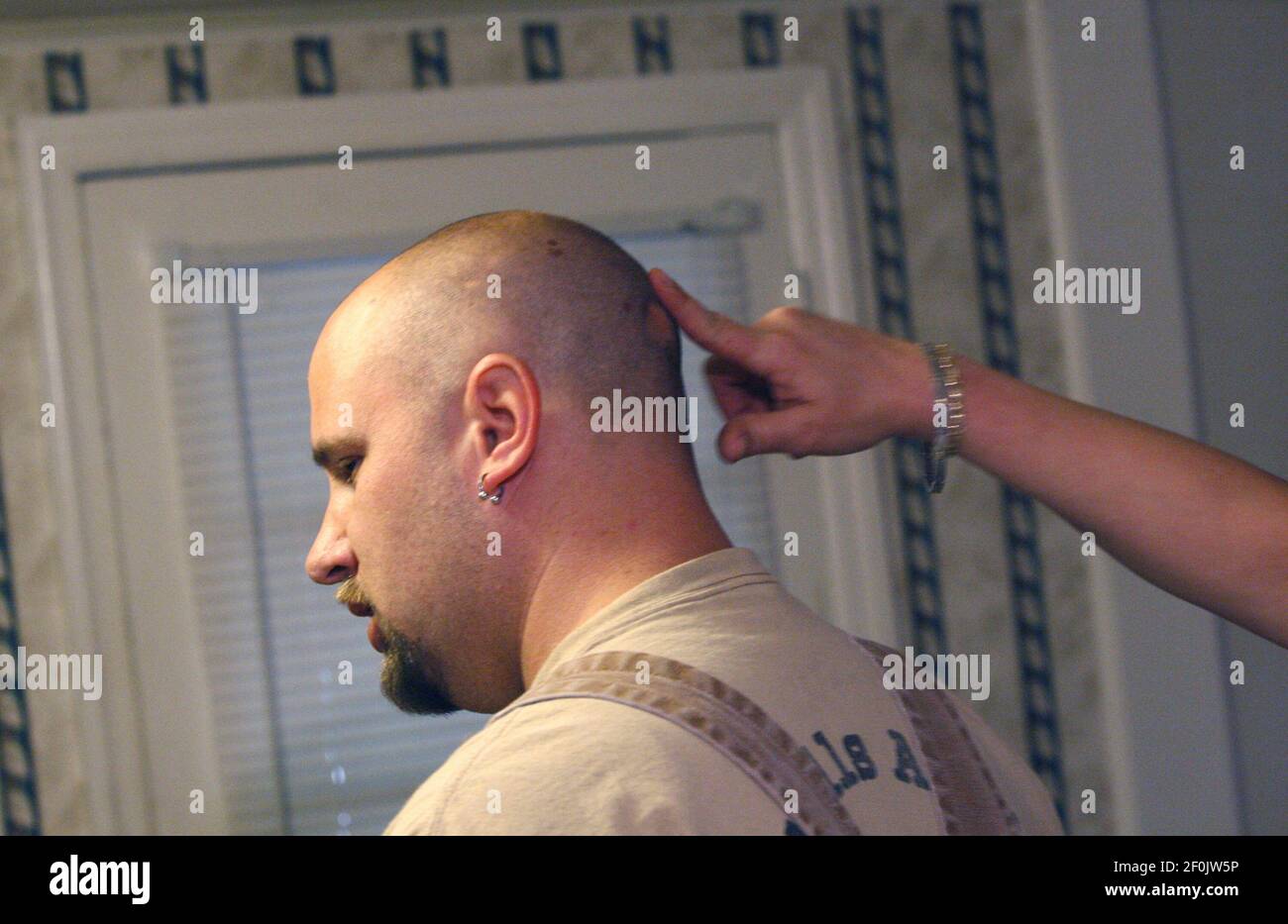 Shannon Pittman runs her finger over a small divot on the back of herr ...