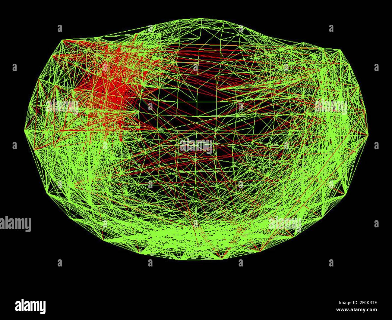 A MEG (magnetoencephalography) image showing a human brain at work ...