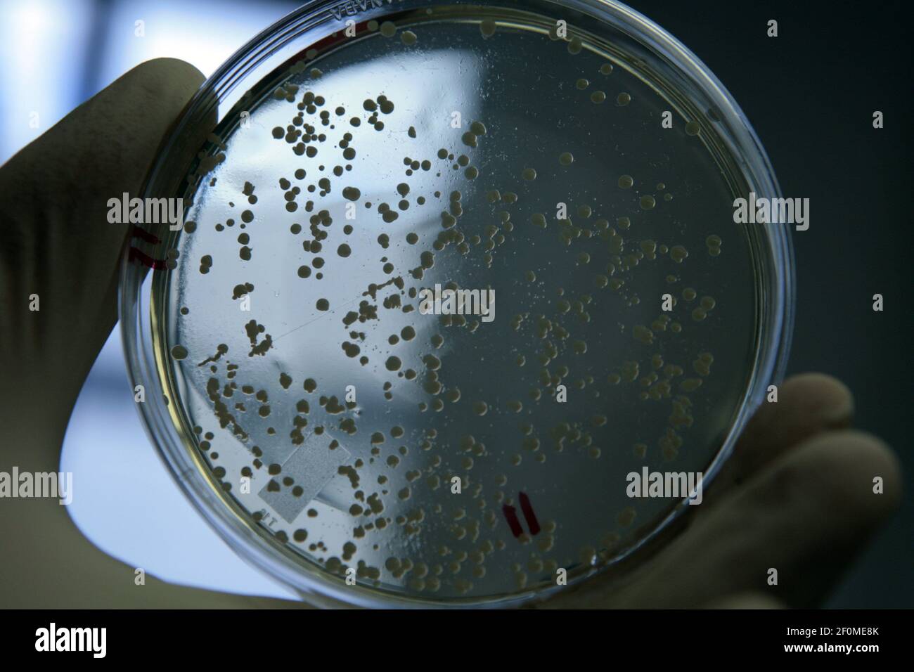 A sample of live MRSA bacteria in a laboratory at the University of ...