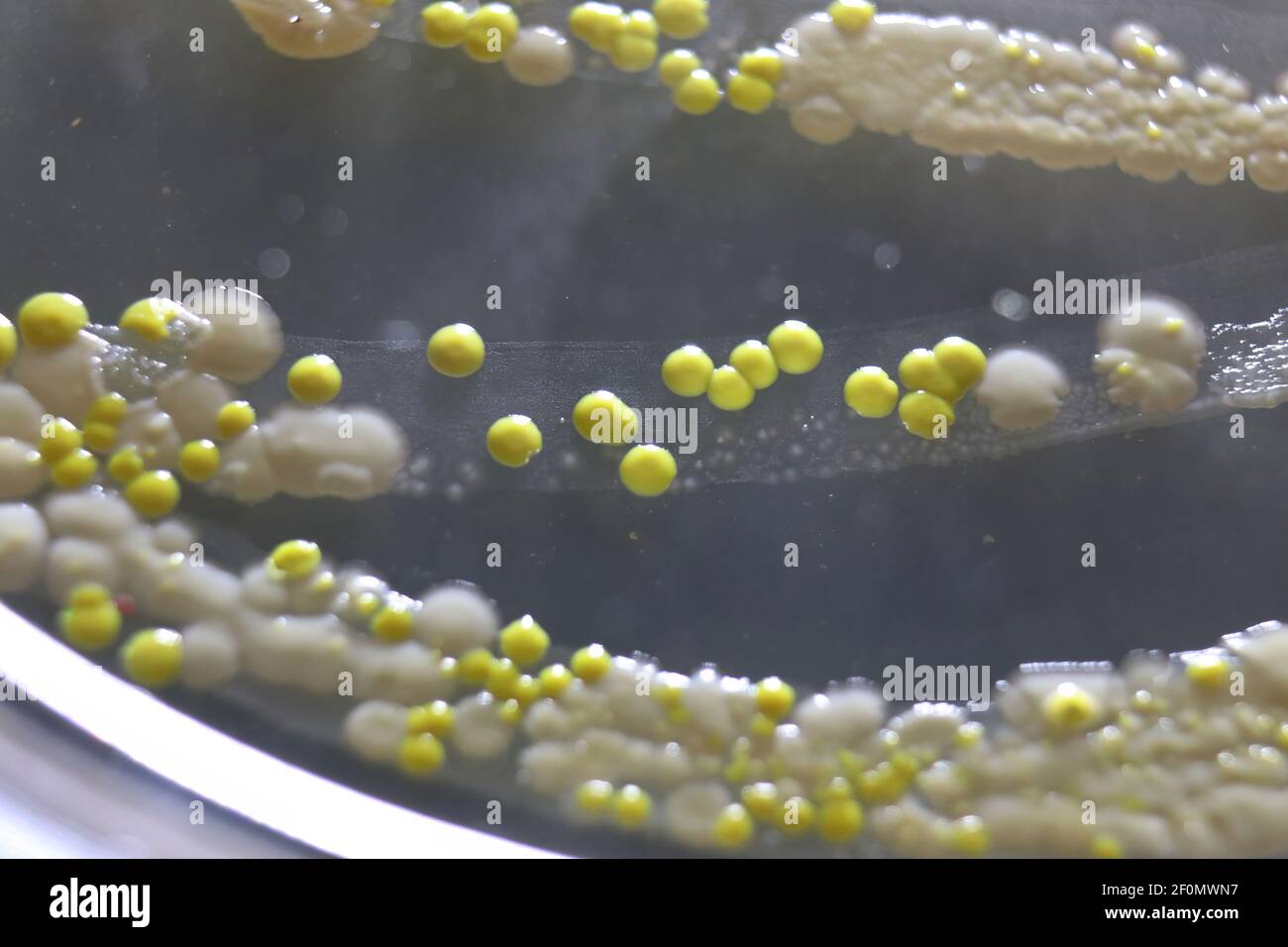 Staphylococcus aureus agar hi-res stock photography and images - Alamy