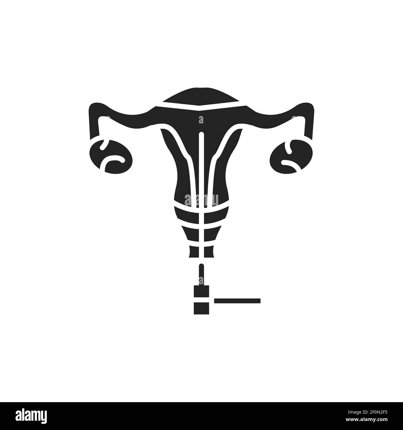 Hysteroscopy examination Stock Vector Images - Alamy