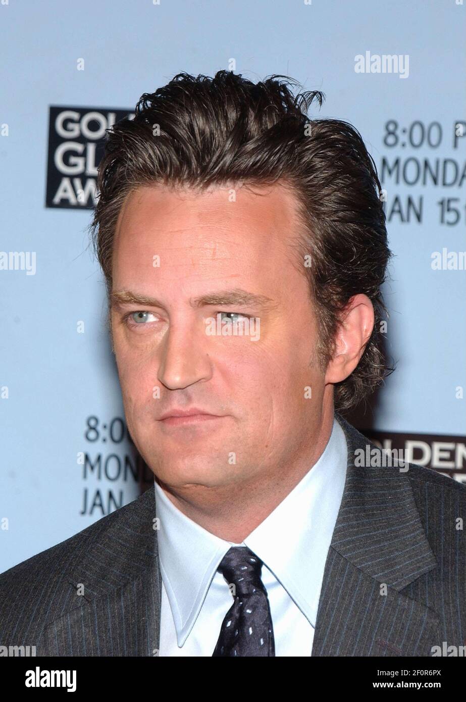 Matthew Perry Hairline