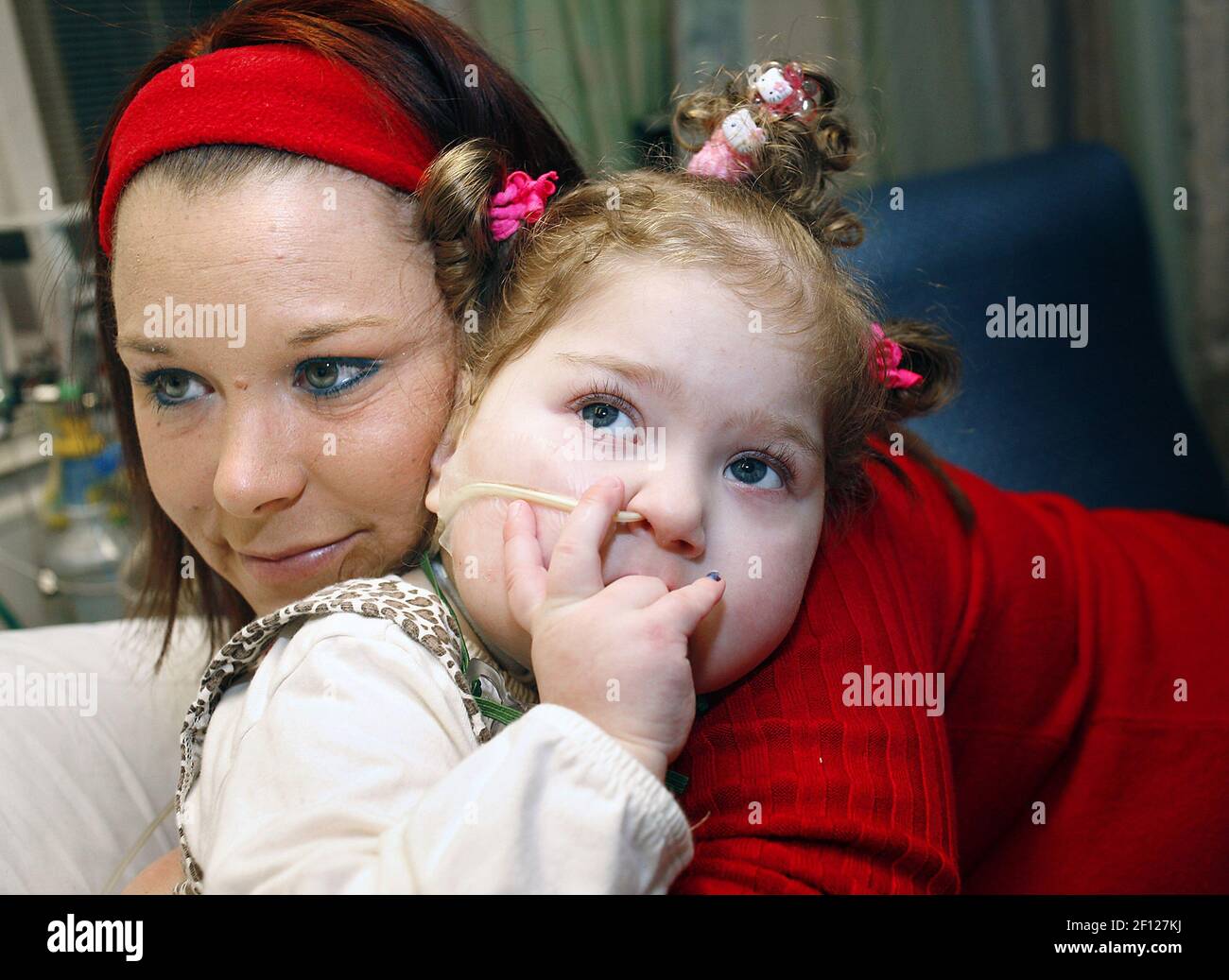 Lisa Nance hugs her daughter Erica Nance, 2, who was born with her ...
