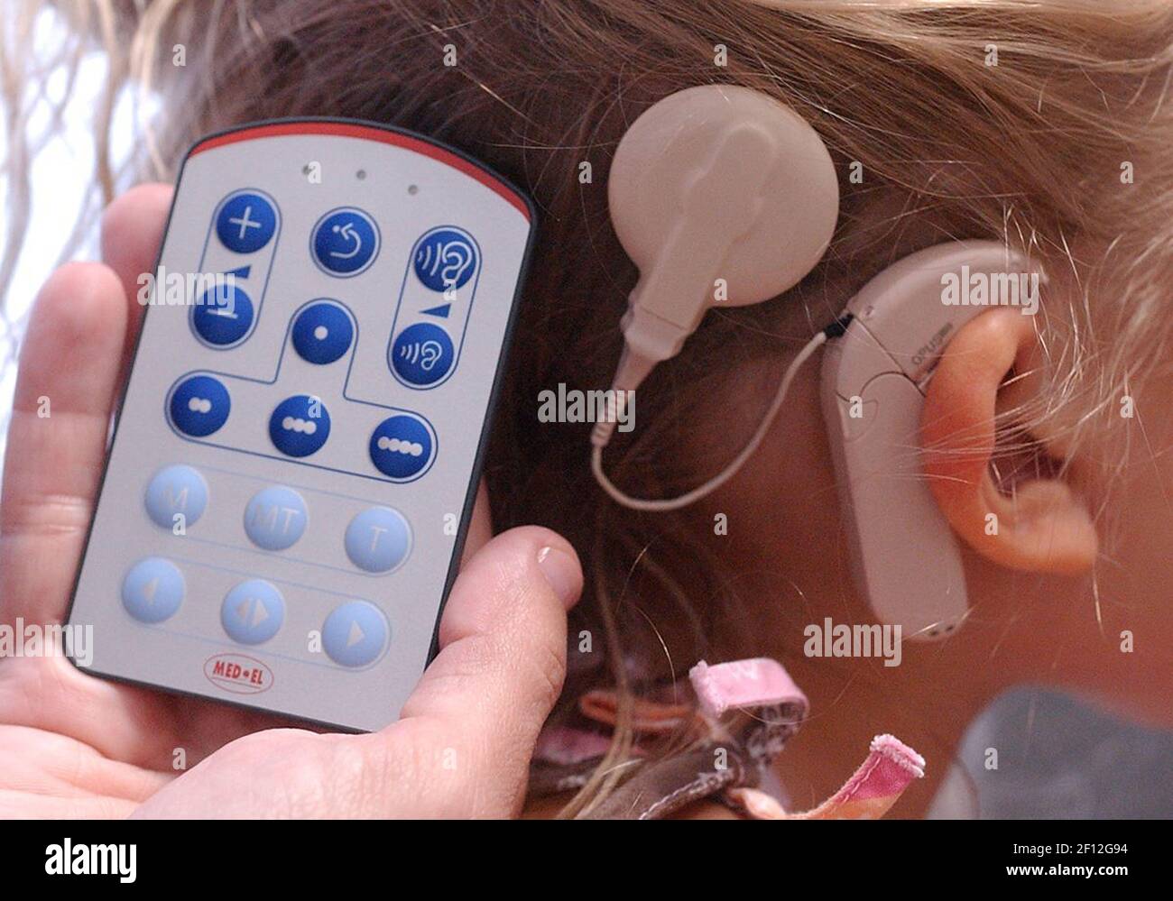 A detailed view of the new remote hand tuner unit for the cochlear ...