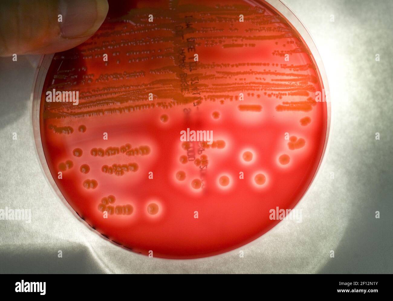 Methicillin-resistant Staphylococcus aureus colonies from a Seattle, Washington hospital patient ...