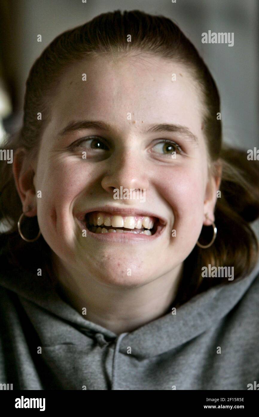 Jeanna Giese is the world's first survivor of the rabies virus without ...