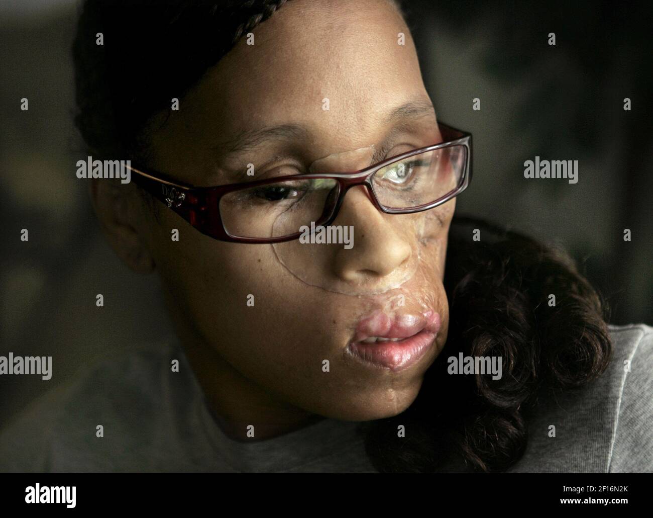 After being shot in the face by her boyfriend three years ago, Waco ...