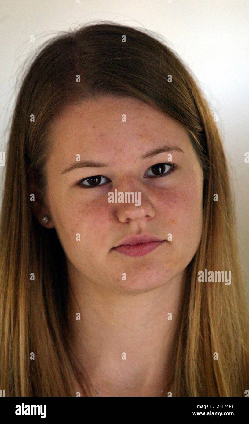 Vicky White, 19, has paruresis, a condition in which people have ...