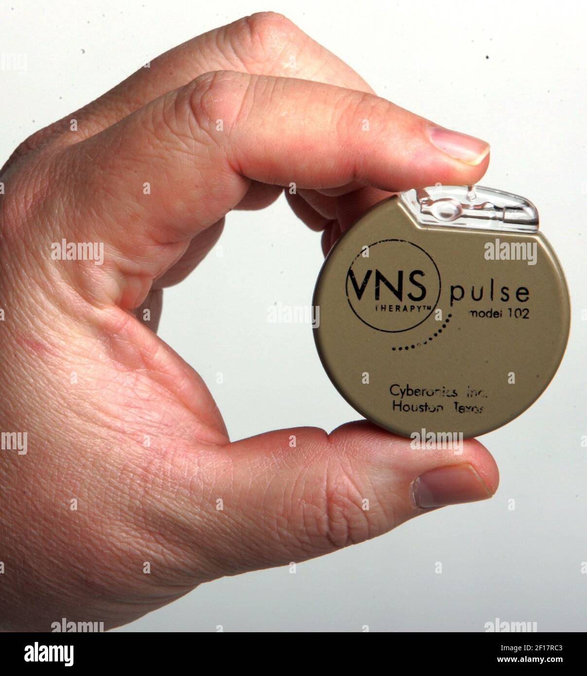 The VNS device is a flat, pacemaker-like generator that is surgically ...