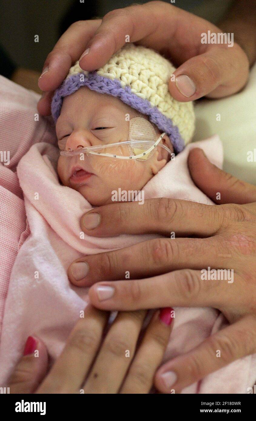 KRT US NEWS STORY SLUGGED: MED-PREMATUREBIRTHS KRT PHOTOGRAPH BY JILL ...