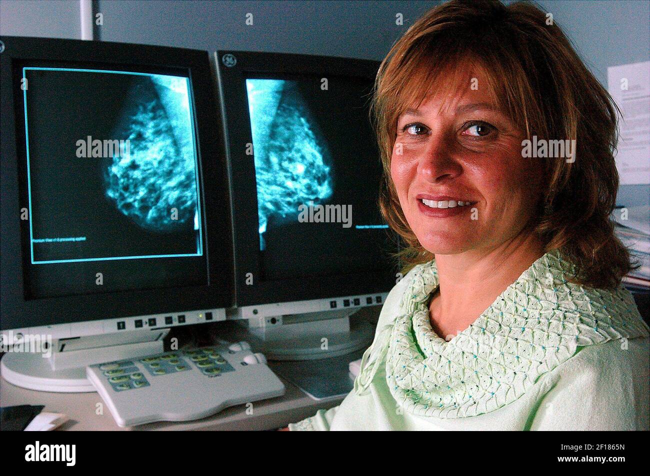 KRT LIFESTYLE STORY SLUGGED: HEALTH-MAMMOGRAPHY KRT PHOTOGRAPH BY BETH ...