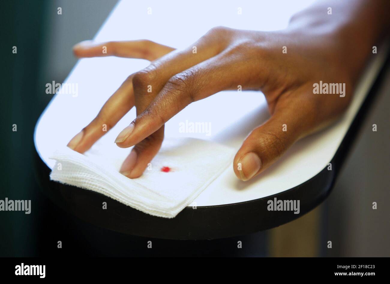 KRT LIFESTYLE STORY SLUGGED: HEALTH-SICKLECELL KRT PHOTO BY LEW STAMP ...