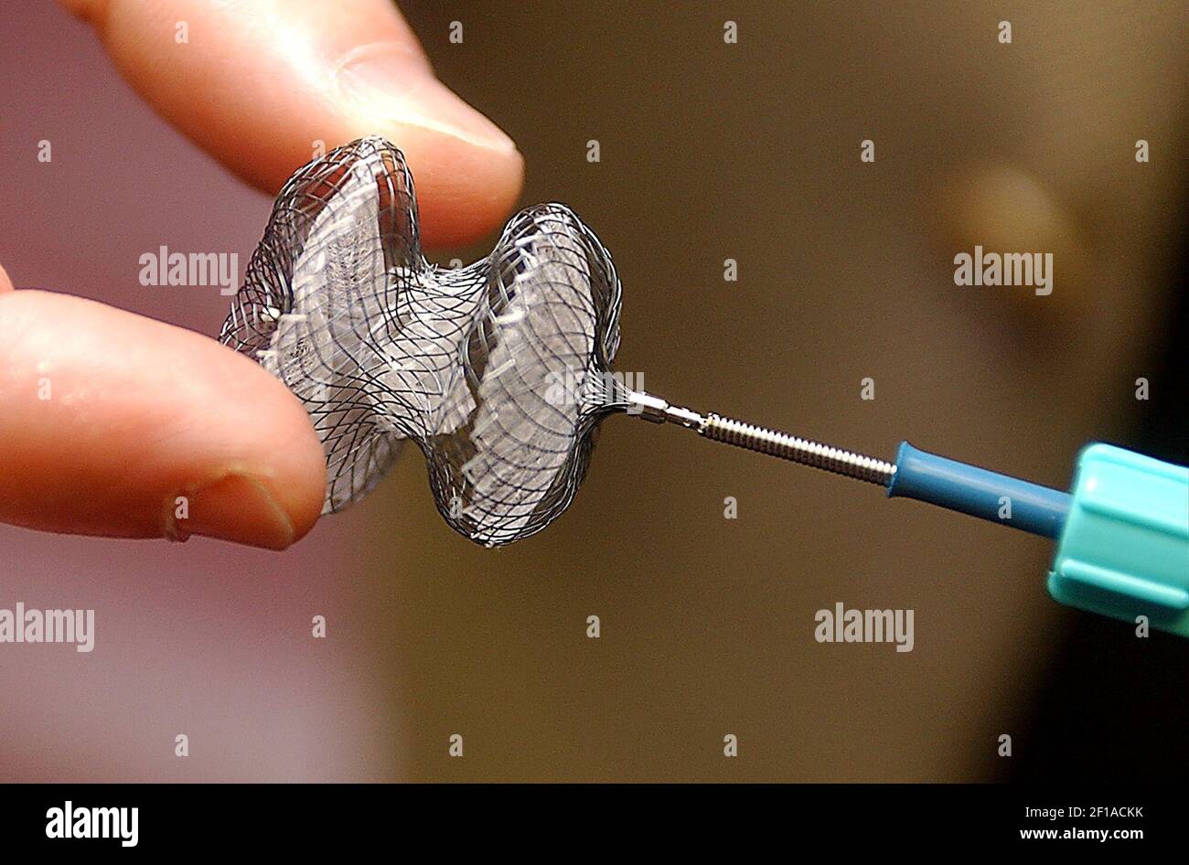 KRT US NEWS STORY SLUGGED: MED-HEARTREPAIR KRT PHOTOGRAPH BY GAYLE ...