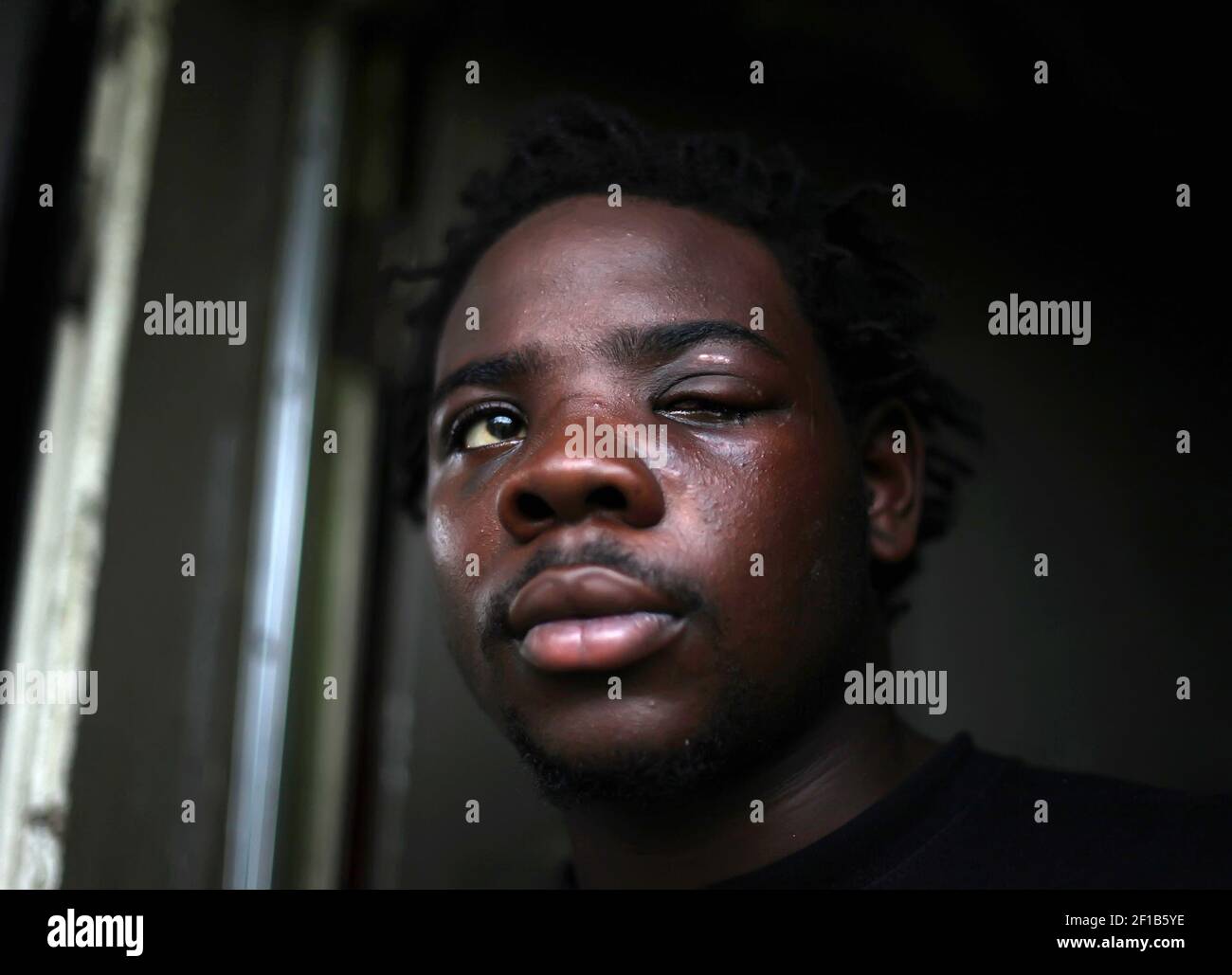 Vashion Bullock, 17, shows in this file photo from October 1, 2009, the ...