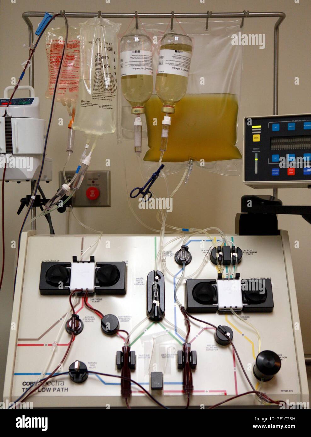 Exchange Transfusion Machine