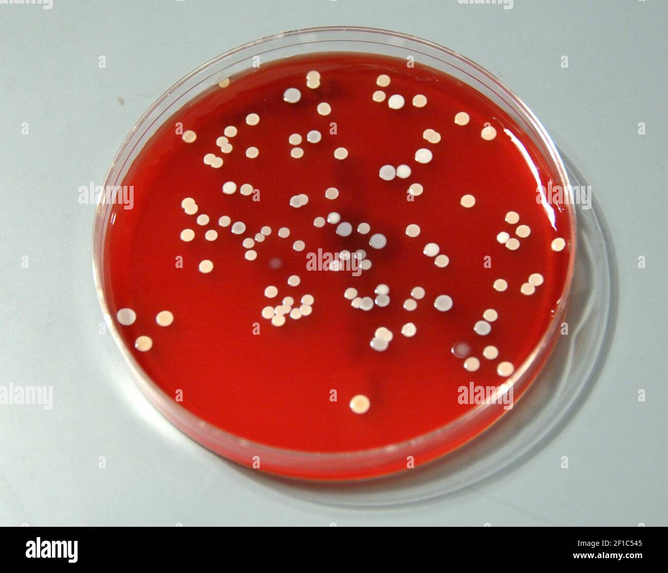 A colony of microbial bacteria from human skin grows in a petri dish at ...