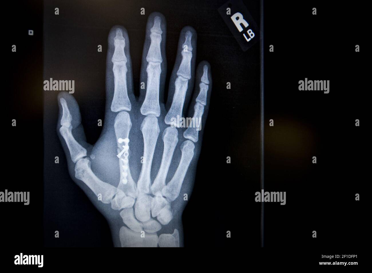 Dr. Soheil Payvandi, an orthopedic hand surgeon views the right hand ...