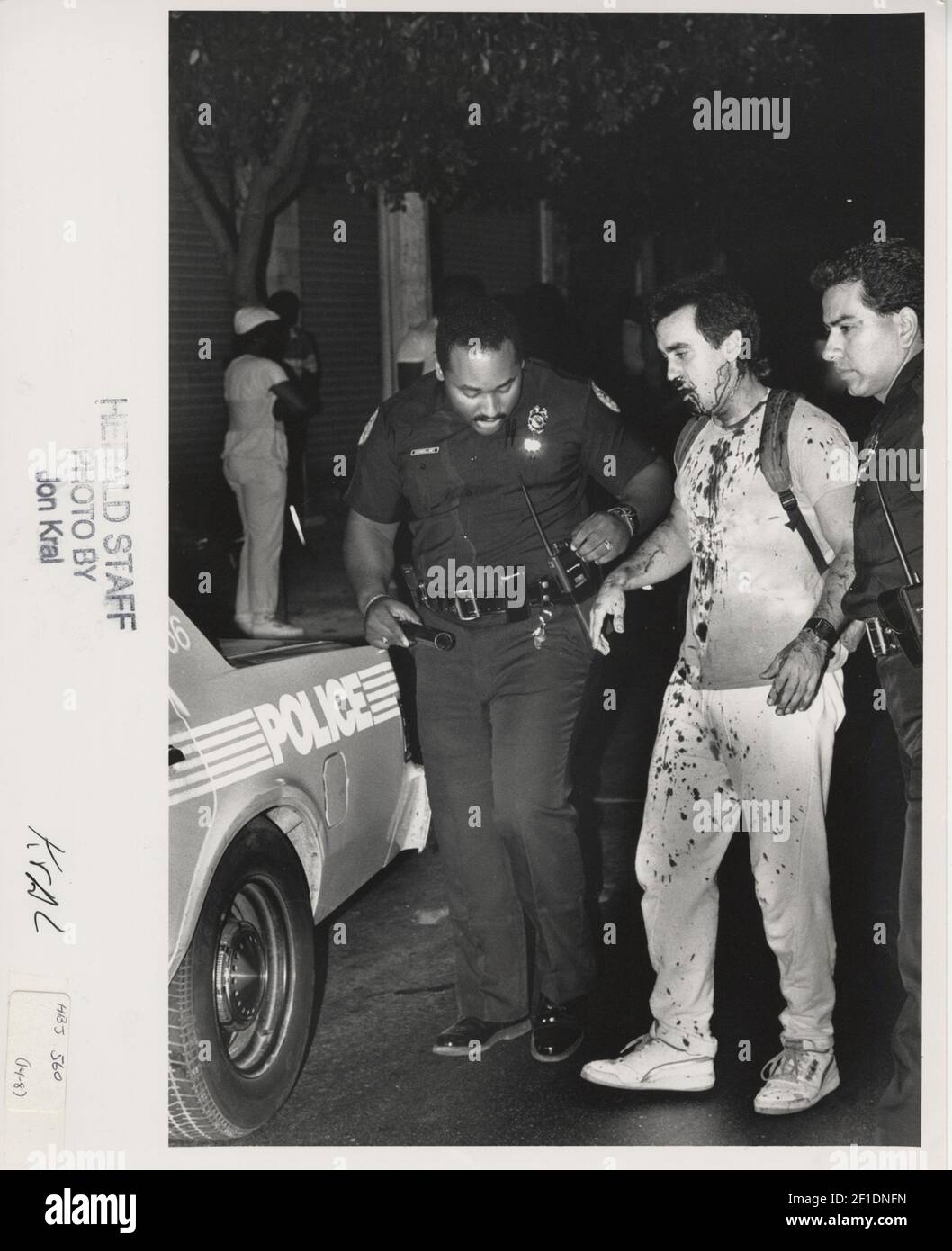 Police help a blood spattered passerby who got caught in the melee and ...