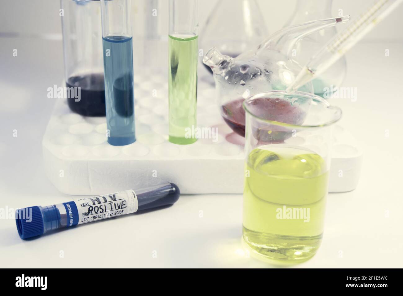 An HIV positive blood test tube on the table with beakers and flasks on ...