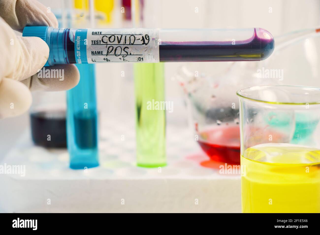 A closeup of a doctor in latex gloves holding a COVID-19 POSITIVE test ...