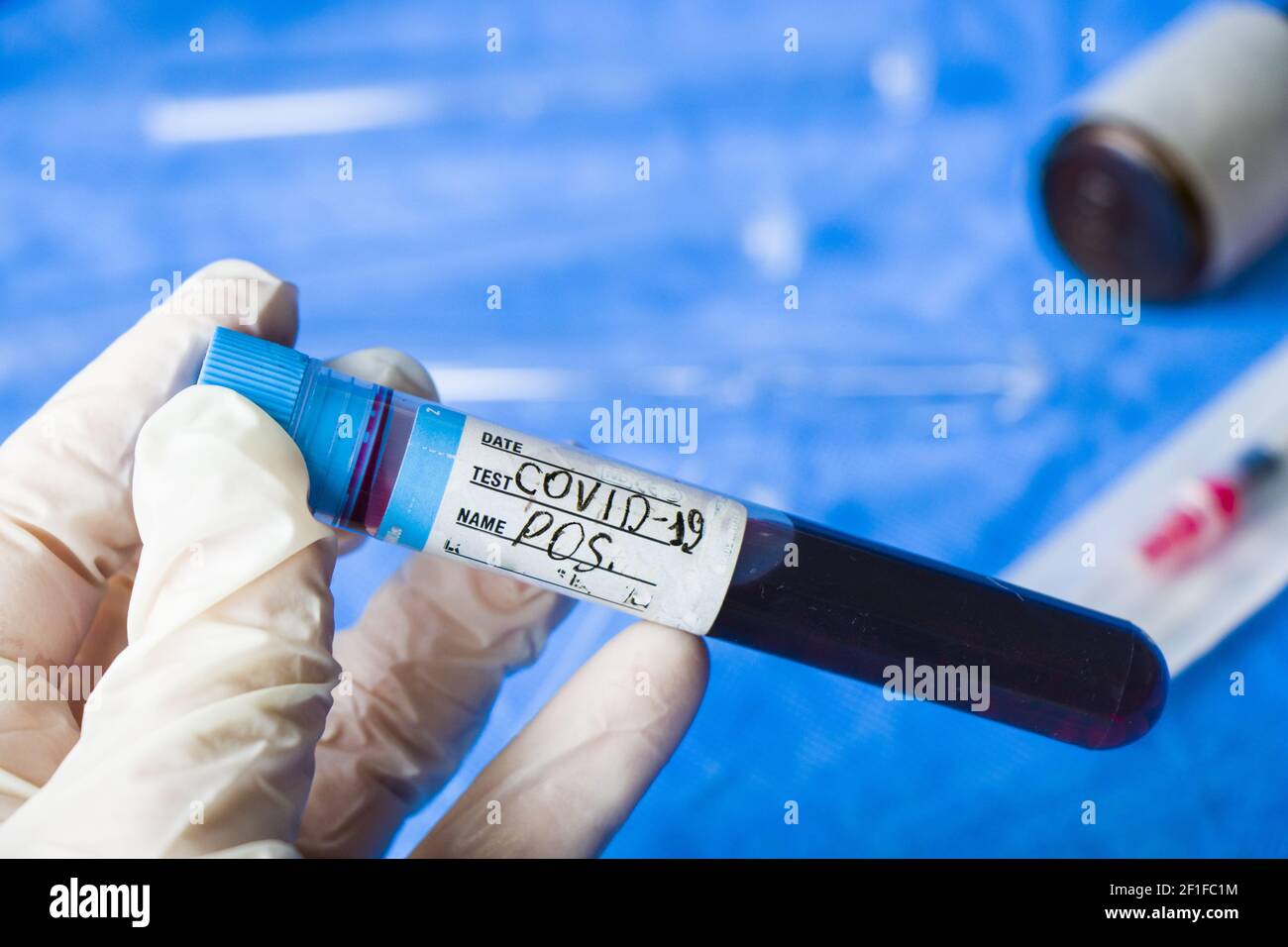A closeup of a doctor in latex gloves holding a COVID-19 POSITIVE test ...